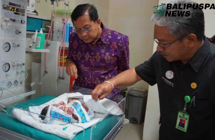 Bayi Kembar Parasit Lahir di Buleleng - Balipuspanews.com